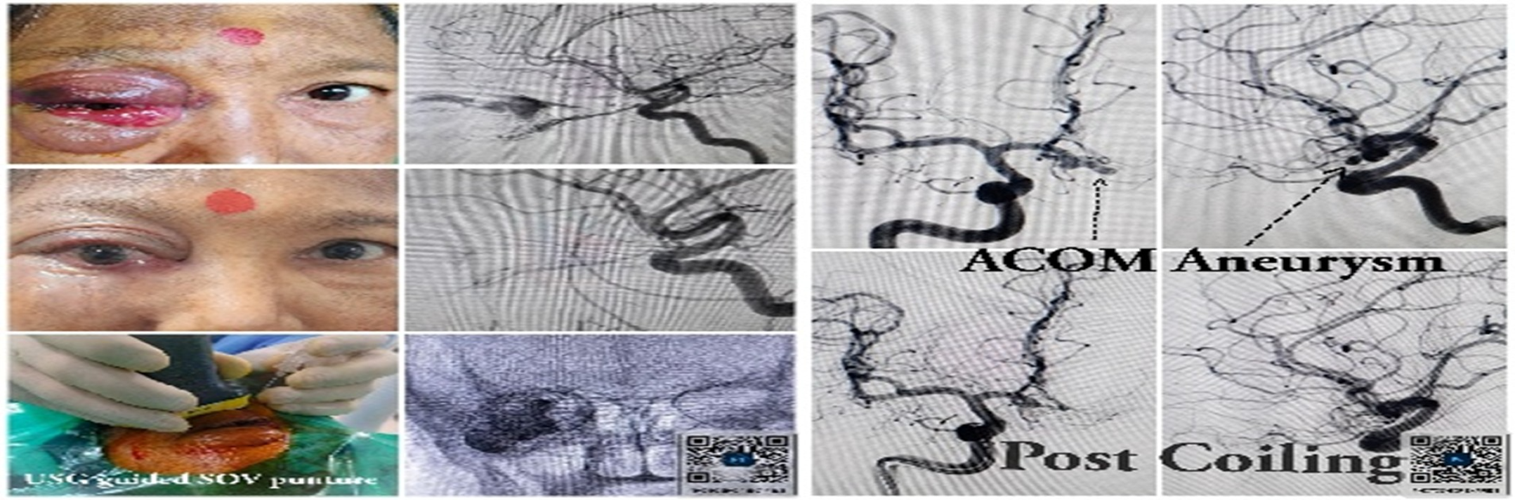 AIIMS Guwahati | Diagnostic & Interventional Radiology
